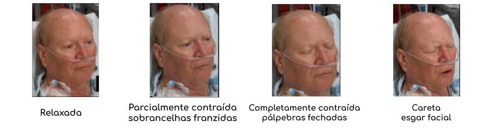 Escala - Behavioral Pain Scale